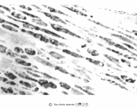 Glaire cervicale : rôle, observation, ovulation et grossesse